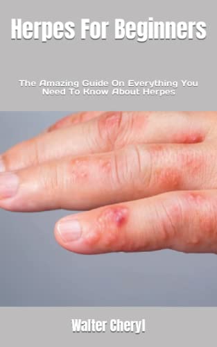 Stages Of Genital Herpes: What You Should Know About Herpes Outbreak – HZGQ