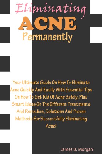 Eliminating Acne Permanently: Your Ultimate Guide On How To Eliminate ...