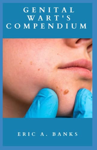 GENITAL WART'S COMPENDIUM: Home Remedies To Destroy Your Genital Warts ...