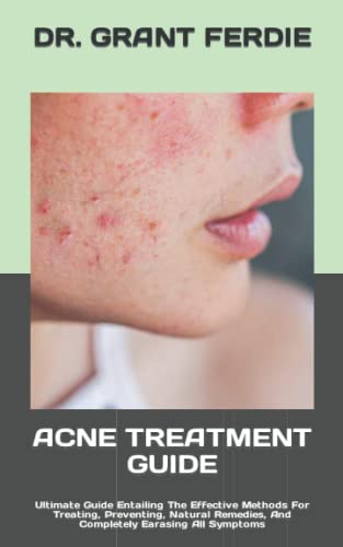 ACNE TREATMENT GUIDE: Ultimate Guide Entailing The Effective Methods ...