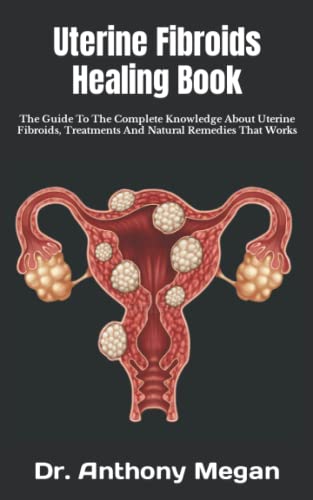 Uterine Fibroids Healing Book: The Guide To The Complete Knowledge ...