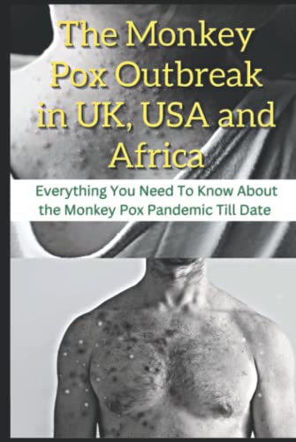 The Monkey Pox Outbreak in UK, USA and Africa: Everything You Need To ...