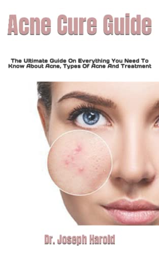 Acne Cure Guide: The Ultimate Guide On Everything You Need To Know ...