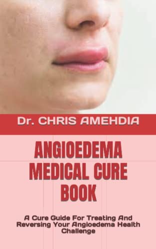 ANGIOEDEMA MEDICAL CURE BOOK: A Cure Guide For Treating And Reversing ...