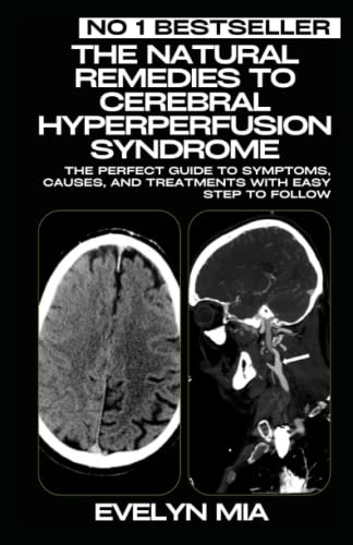 The Natural Remedies To Cerebral Hyperperfusion Syndrome: The Perfect ...