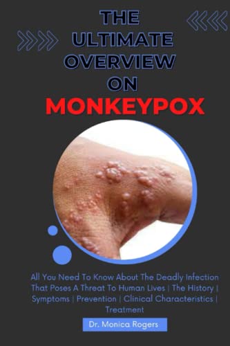 THE ULTIMATE OVERVIEW ON MONKEYPOX: All You Need To Know About The Deadly Infection That Poses A ...