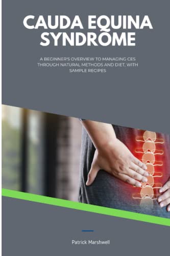 Learn To Spot And Treat Cauda Equina Syndrome – UFGQM