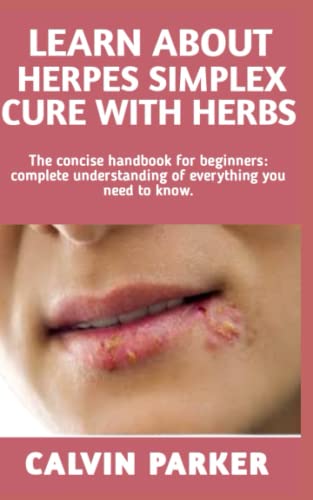 Learn About Herpes Simplex Cure With Herbs: Concise Manual: (symptoms ...