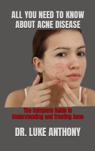 ALL YOU NEED TO KNOW ABOUT ACNE DISEASE: The Complete Guide to ...