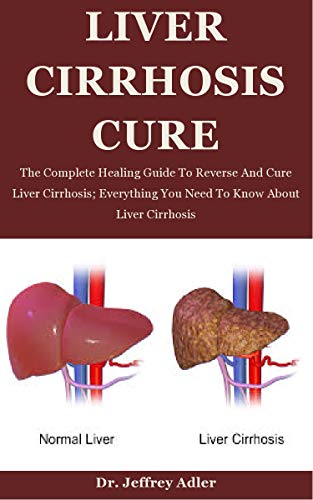 Liver Cirrhosis Cure: The Complete Healing Guide To Reverse And Cure ...