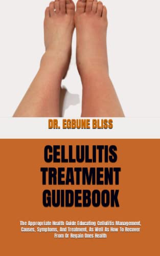 CELLULITIS TREATMENT GUIDEBOOK: The Appropriate Health Guide Educating ...