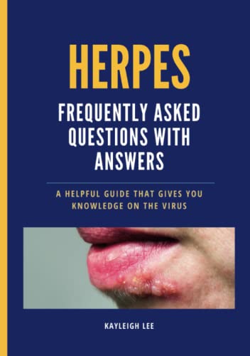 Genital and Oral Herpes FAQ: Frequently Asked Questions About Herpes ...