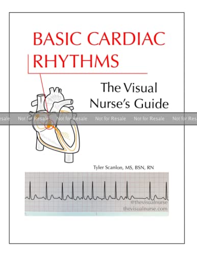 PROOF: Basic Cardiac Rhythms: The Visual Nurse's Guide by Tyler Scanlon ...