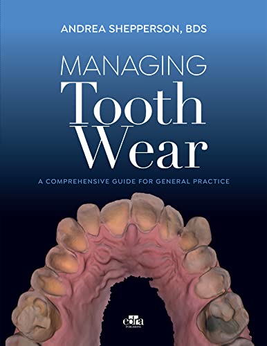 Managing Tooth Wear: A comprehensive guide for general practice by ...