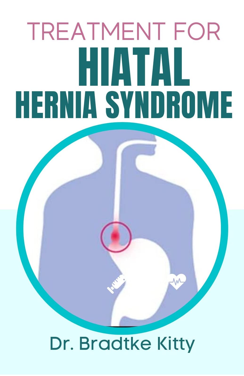 Treatment For Hiatal Hernia Syndrome: Complete Guide To Understanding ...