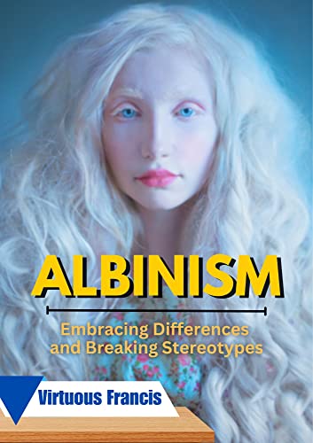 Albinism: Embracing Difference and Breaking Stereotypes by Virtuous ...