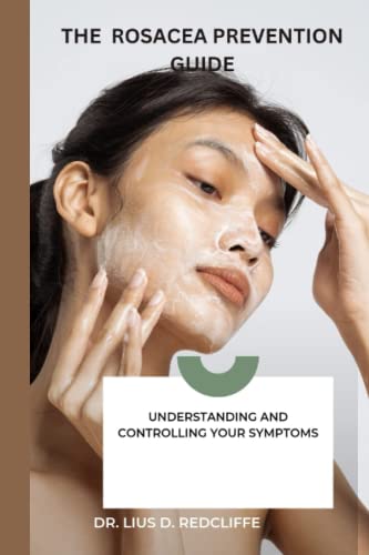 THE ROSACEA PREVENTION GUIDE: Understanding and Controlling your ...