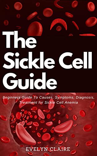 THE SICKLE CELL GUIDE: Beginners Guide To Causes, Symptoms, Diagnosis ...