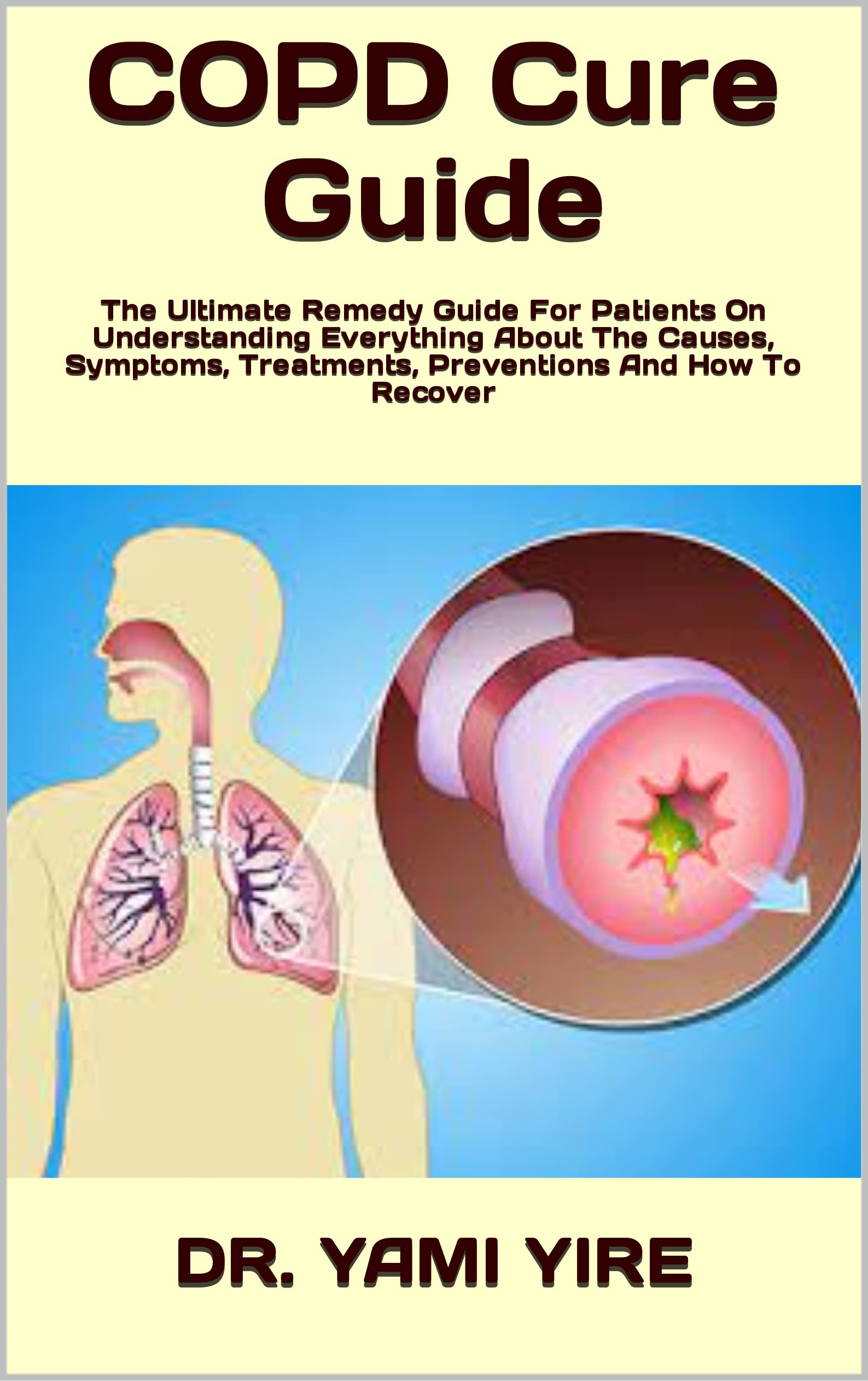 COPD Cure Guide : The Ultimate Remedy Guide For Patients On ...