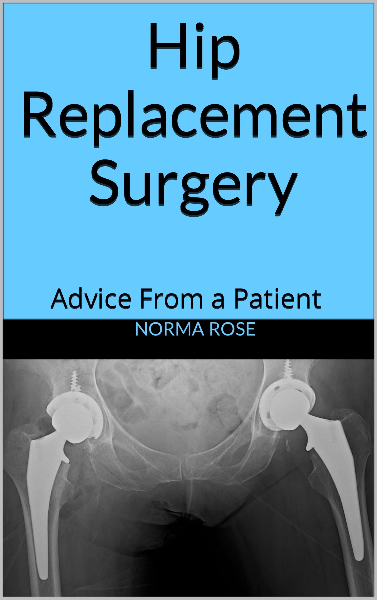 Hip Replacement Surgery : Advice From a Patient by Norma Rose | Goodreads
