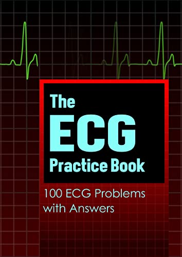 The ECG Practice Book: 100 ECG Problems with Solutions by ECG Books ...