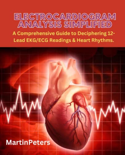 Electrocardiogram Analysis Simplified: A Comprehensive Guide to ...
