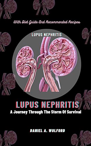 LUPUS NEPHRITIS : THE JOURNEY THROUGH THE STORM: Living and Thriving ...