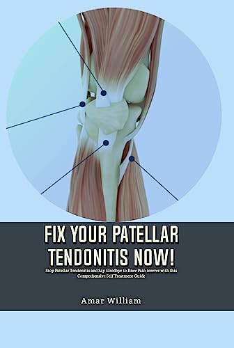 Fix Your Patellar Tendonitis Now! : Stop Patellar Tendonitis and Say ...