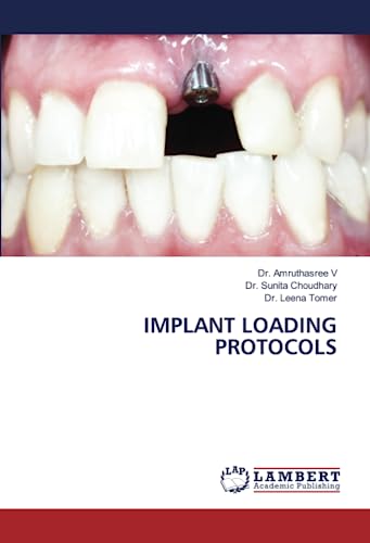 IMPLANT LOADING PROTOCOLS by Dr. Amruthasree V | Goodreads
