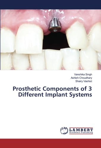Prosthetic Components of 3 Different Implant Systems by Vanshika Singh ...