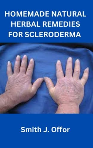 HOMEMADE NATURAL HERBAL REMEDIES FOR SCLERODERMA by Smith J. Offor ...