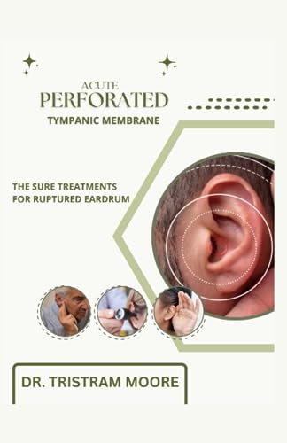 ACUTE PERFORATED TYMPANIC MEMBRANE: THE SURE TREATMENTS FOR RUPTURED ...