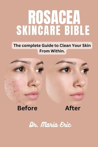 ROSACEA SKINCARE BIBLE: The complete Guide to Clean Your Skin From ...