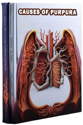 Causes of Purpura: Understand the potential causes of purpura, a skin ...