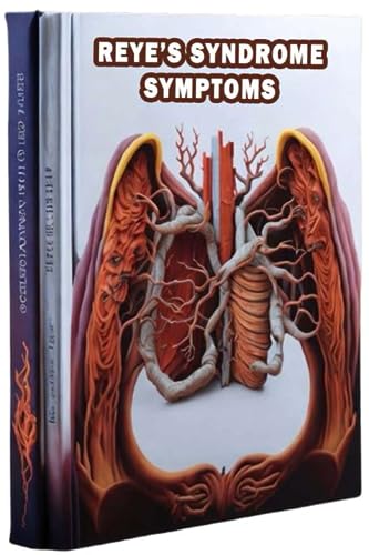 Reye's Syndrome Symptoms: Learn about the symptoms and risks of Reye's ...