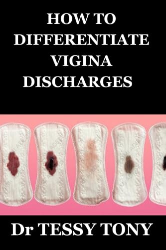 How To Differentiate Vigina Discharges by Dr TESSY TONY | Goodreads