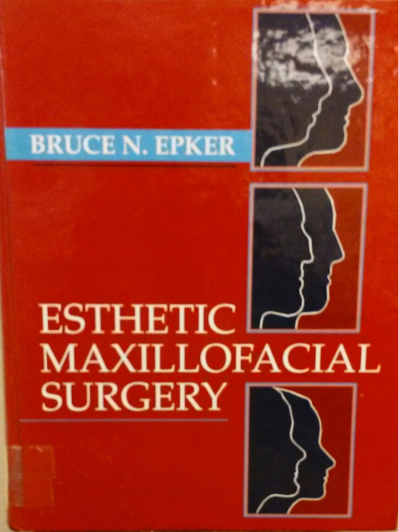 Esthetic Maxillofacial Surgery by Bruce N. Epker | Goodreads