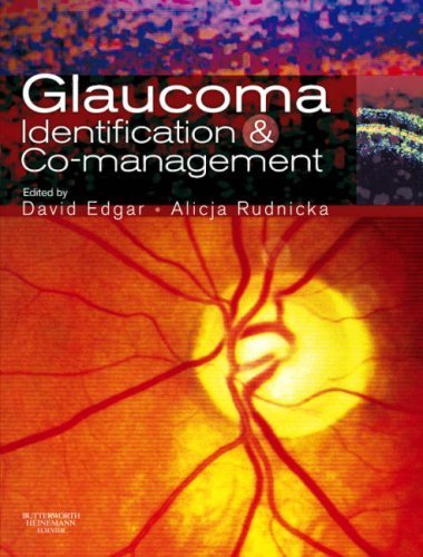 Glaucoma: Identification and Co-Management 1st edition by Edgar, David ...
