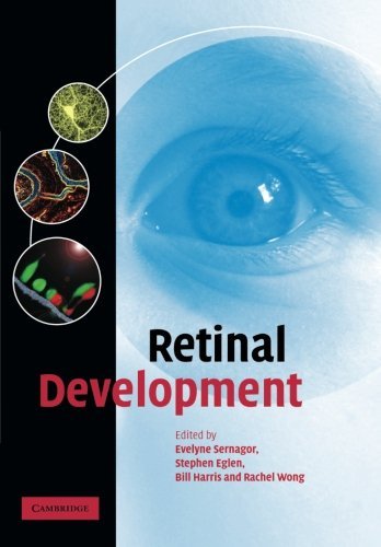 Retinal Development (2012-11-29) by Evelyne Sernagor | Goodreads