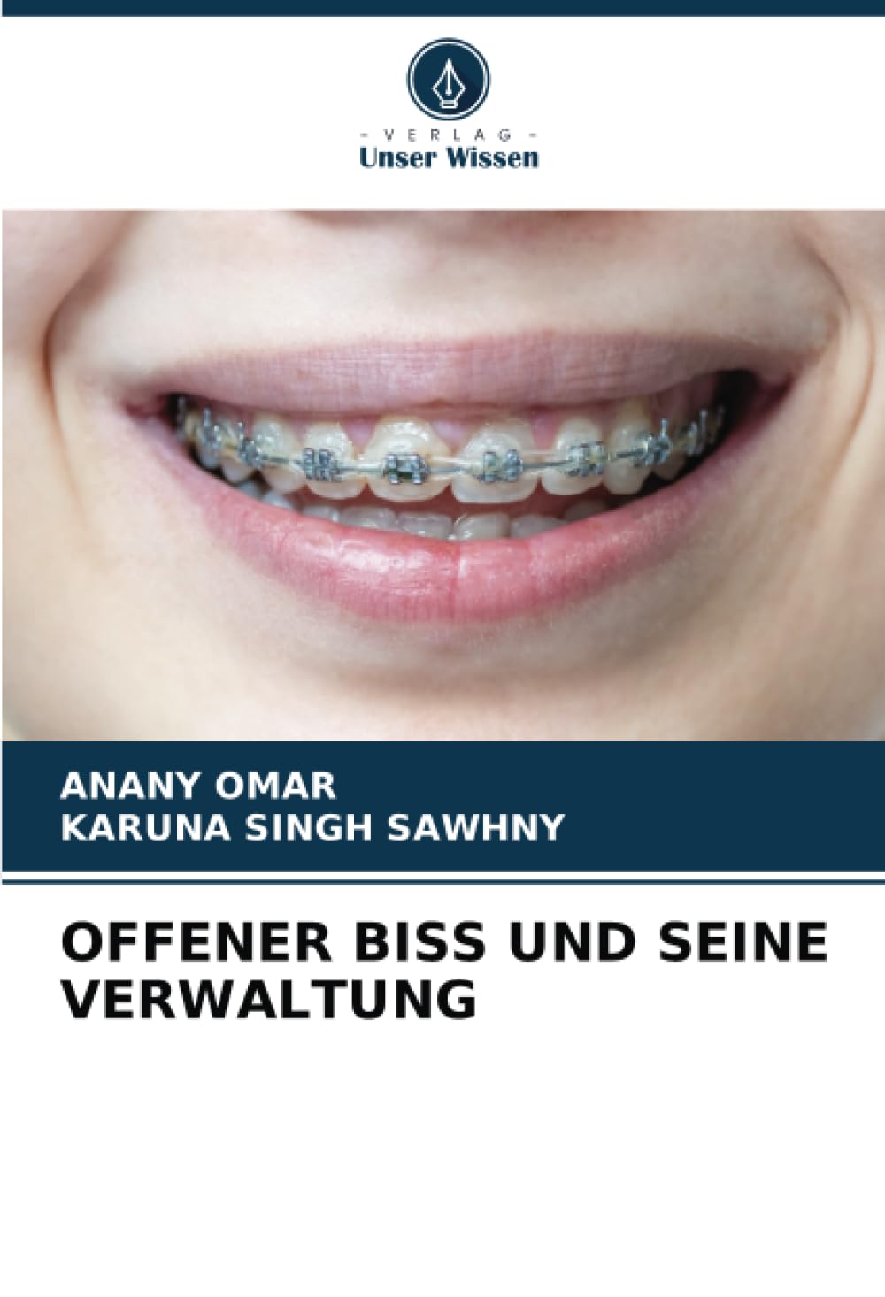OFFENER BISS UND SEINE VERWALTUNG (German Edition) by Anany Omar ...