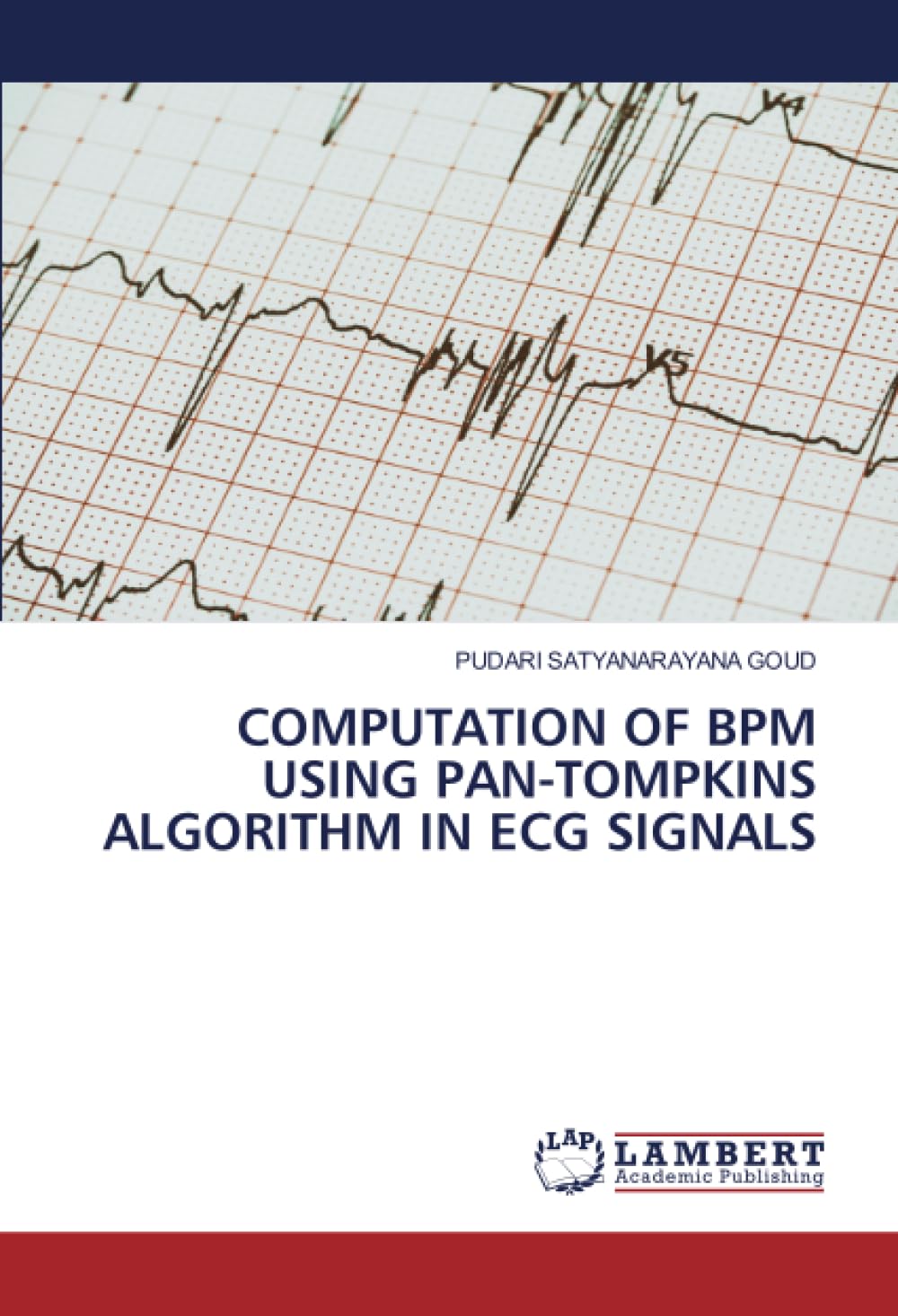 COMPUTATION OF BPM USING PAN-TOMPKINS ALGORITHM IN ECG SIGNALS by PUDARI Satyanarayana Goud ...