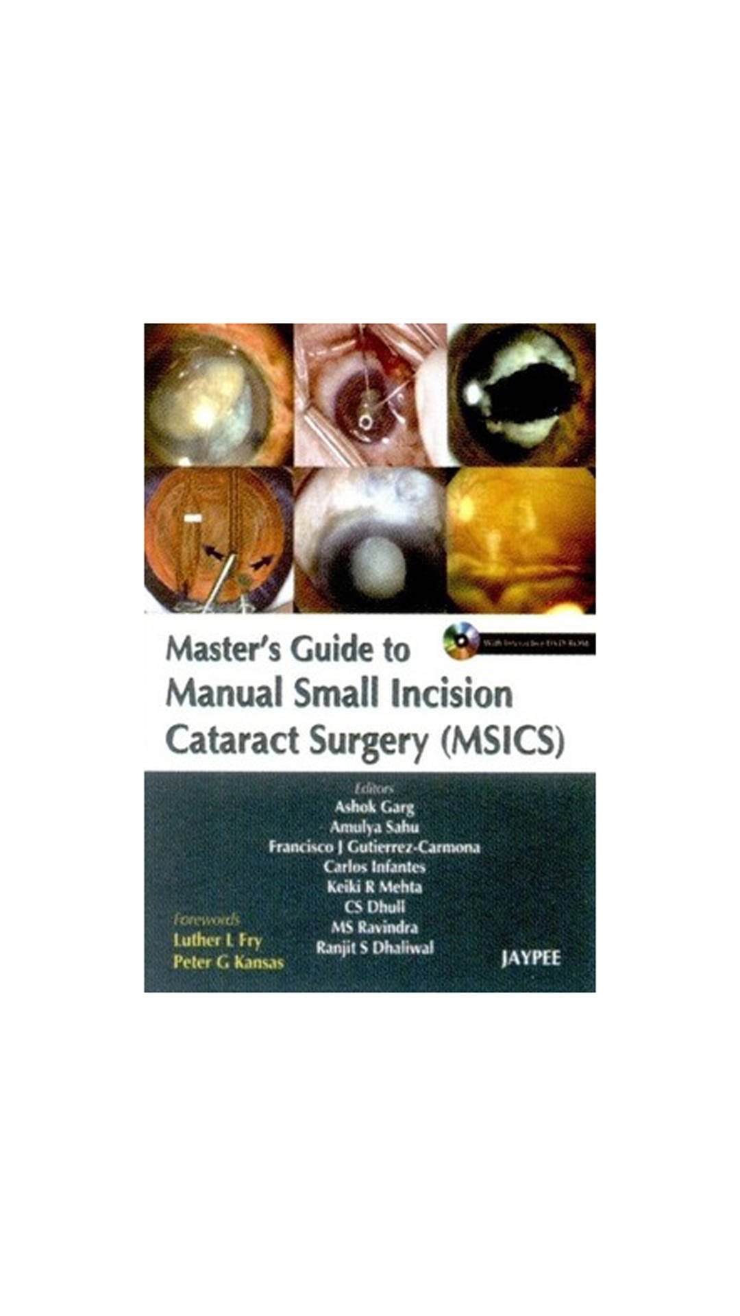 Masters Guide to Manual Small Incision by Garg | Goodreads