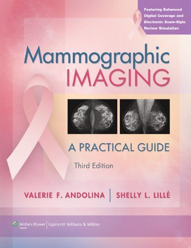 Mammographic Imaging: A Practical Guide (Point (Lippincott Williams ...