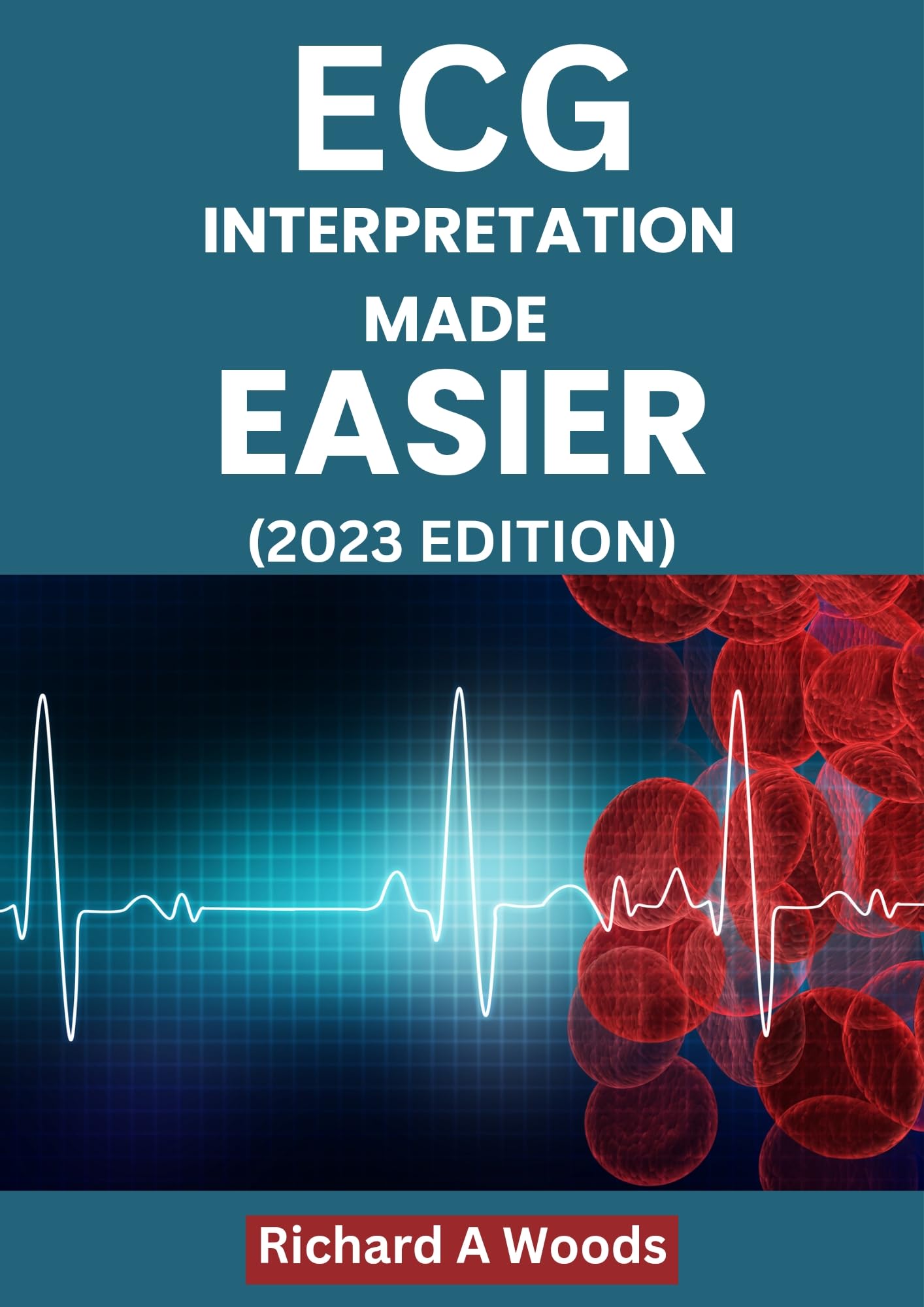 ECG INTERPRETATION MADE EASIER(2023 EDITION): A beginners guide to understanding,reading and ...