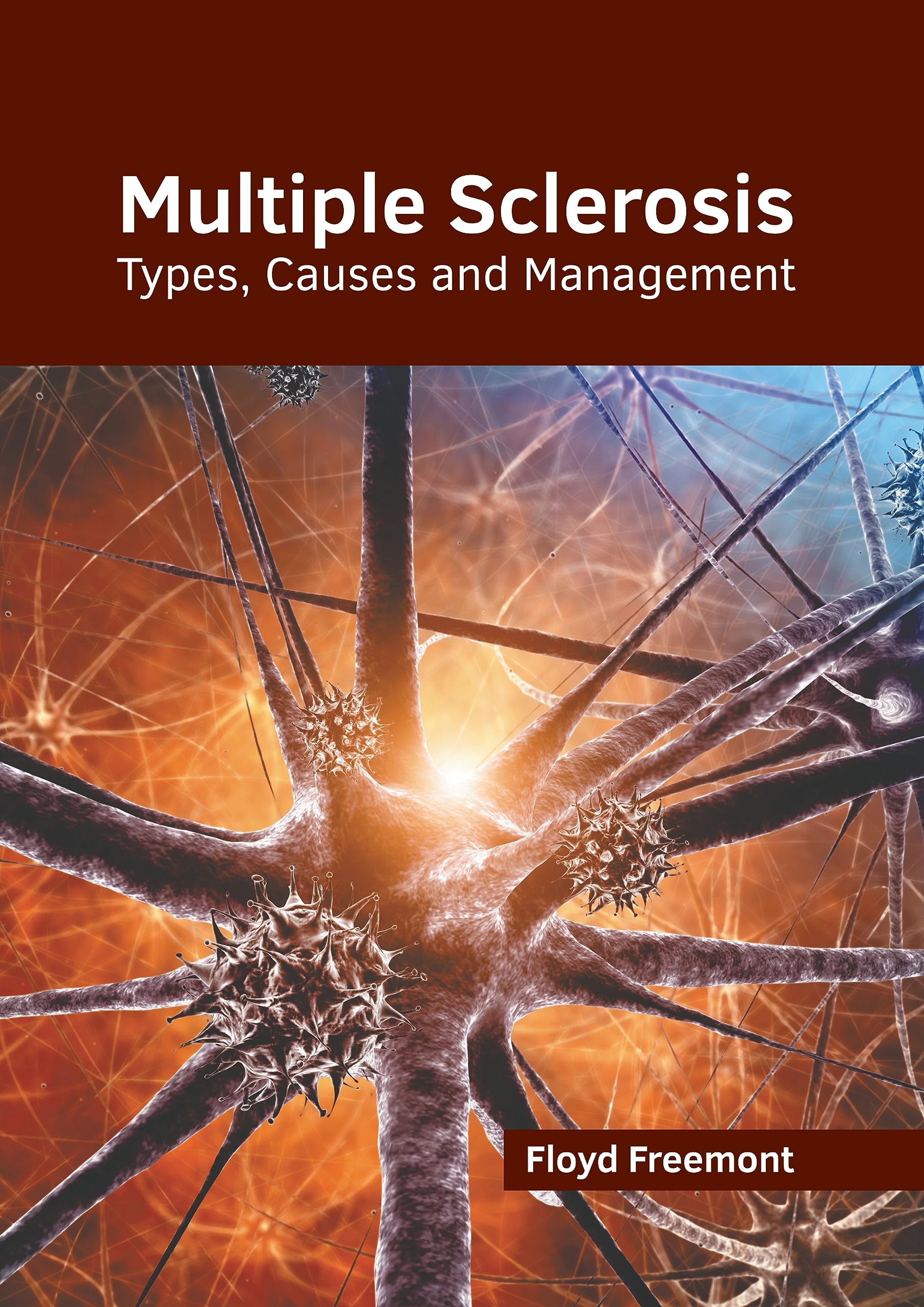 Multiple Sclerosis: Types, Causes and Management by Floyd Freemont | Goodreads