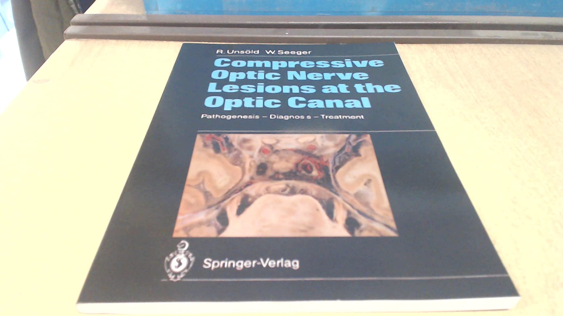 Compressive Optic Nerve Lesions at the Optic Canal: Pathogenesis ...