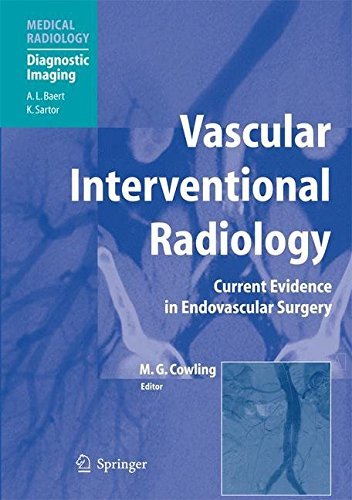 Vascular Interventional Radiology: Angioplasty, Stenting, Thrombolysis ...