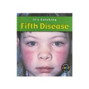 It's Catching Fifth Disease by Elizabeth Laskey | Goodreads