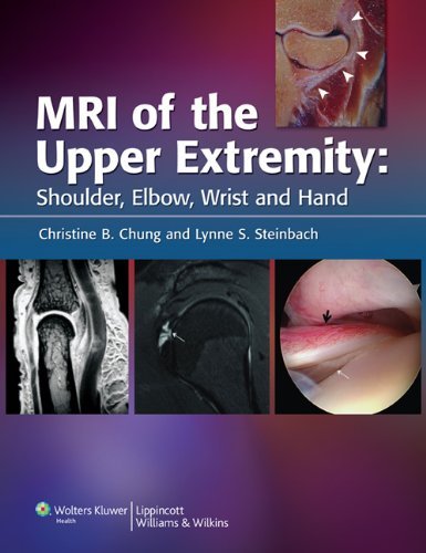 MRI of Upper Extremity: Shoulder, Elbow, Wrist, And Hand by Christine B. Chung by Christine B ...