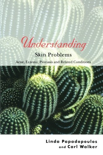 Understanding Skin Problems: Acne, Eczema, Psoriasis and Related ...